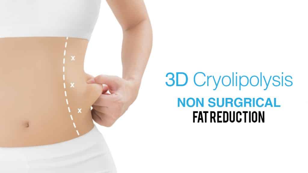 3D Cryolipolysis - How Does It Work? 3D Lifestyle PK