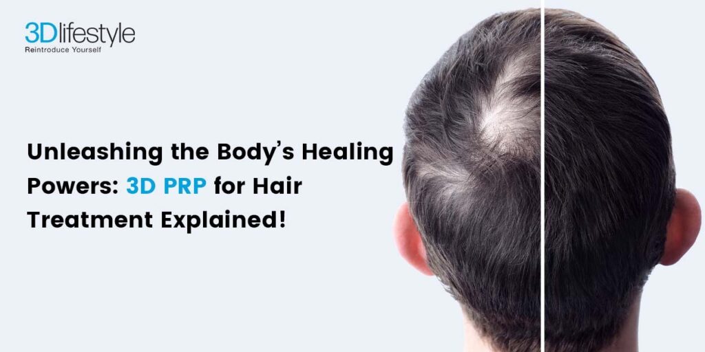 Unleashing the Body’s Healing Powers: 3D PRP for Hair Treatment ...